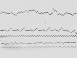 EEG Guide – EMOTIV